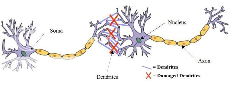 "The first wealth is health." -Ralph Waldo Emerson, Dendrites The human ...